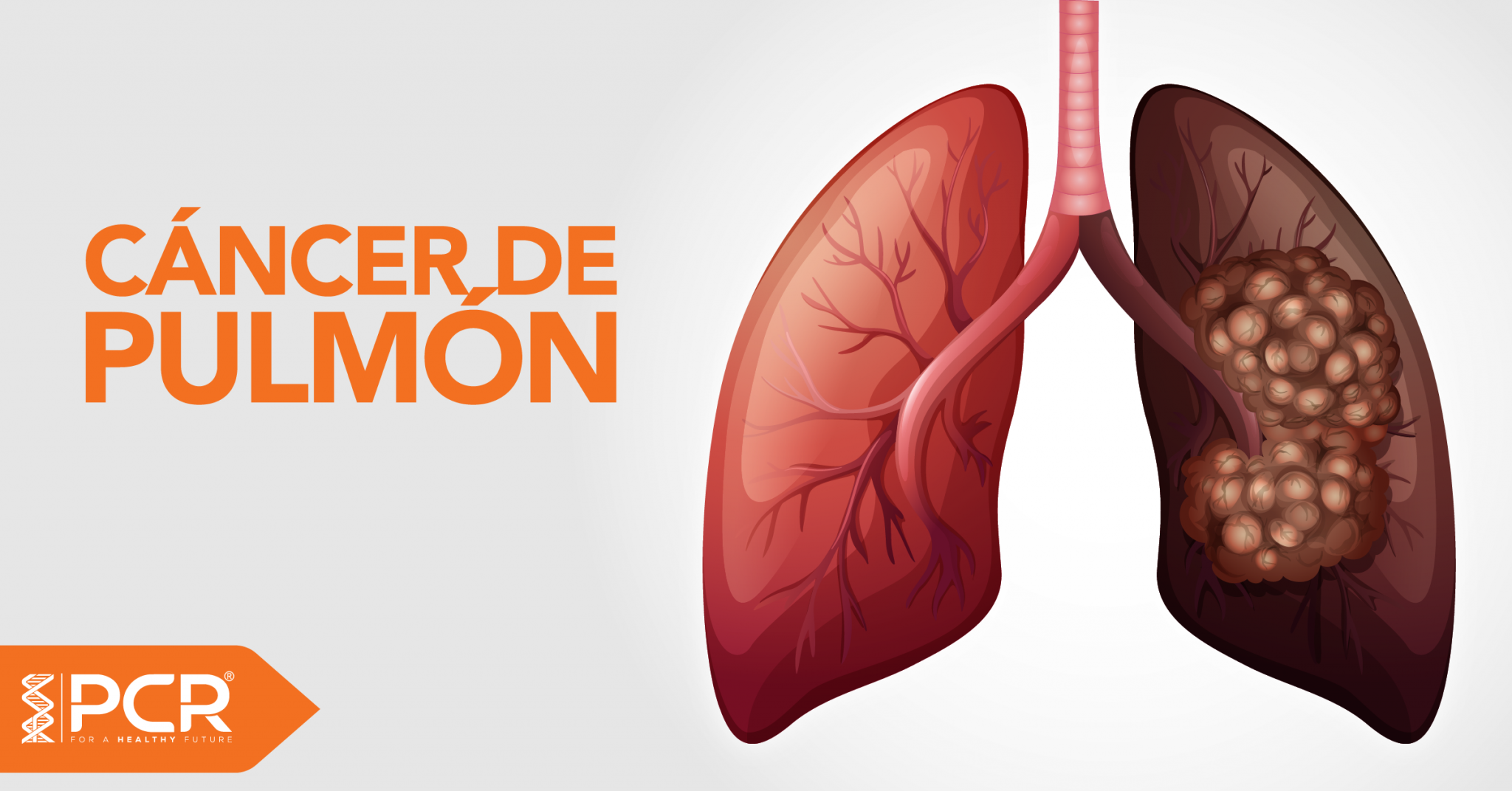 Cáncer de Pulmón – PCR